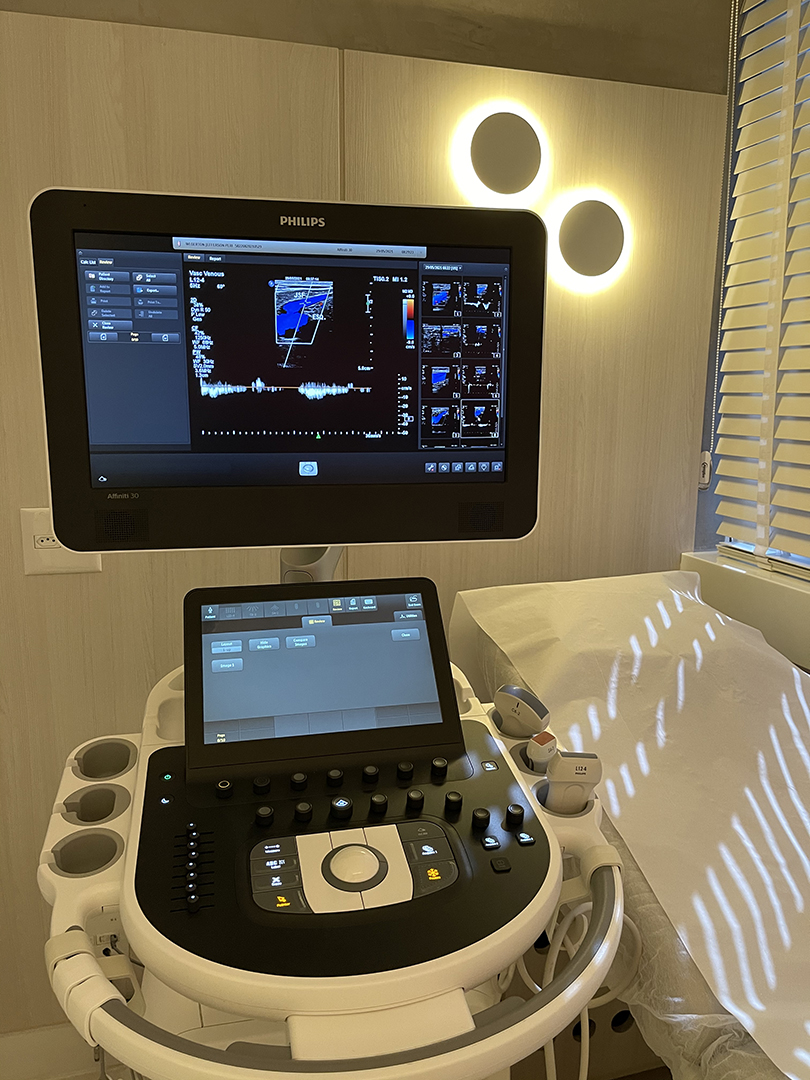 Eco Color Doppler Vascular – Clínica Fluxus